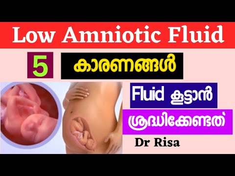 Compications of Pregnancy|Low Amniotic Fluid Malayalam|Tips To increae Mniotic Fluid level - YouTube