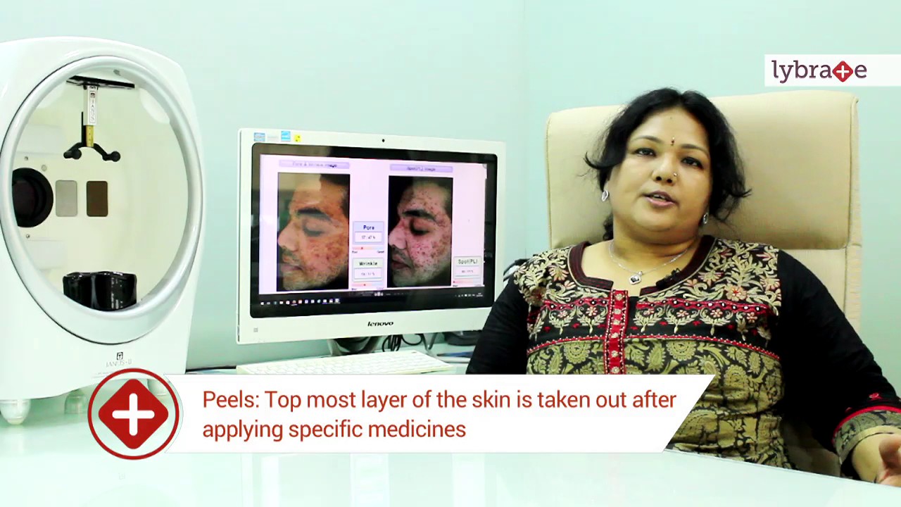 Lybrate | Dr Jolly Shah Talks About Acne Scars - YouTube