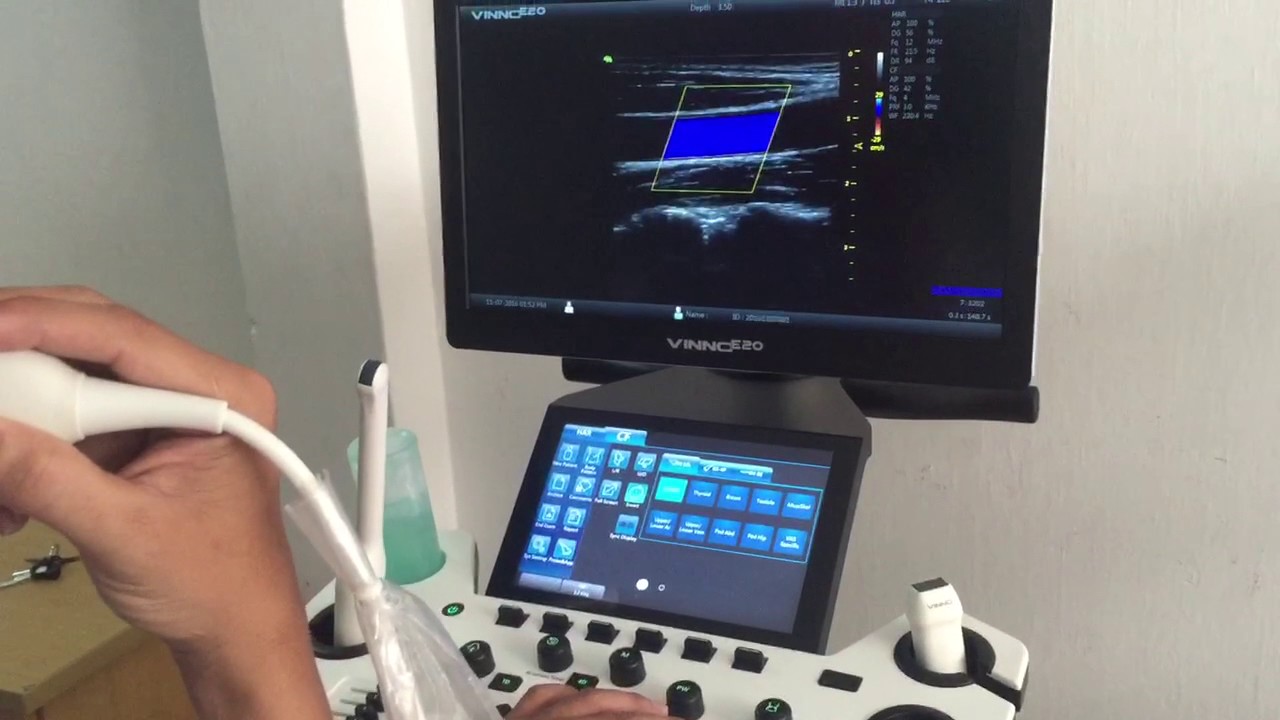 VINNO E20 - DEMO - YouTube