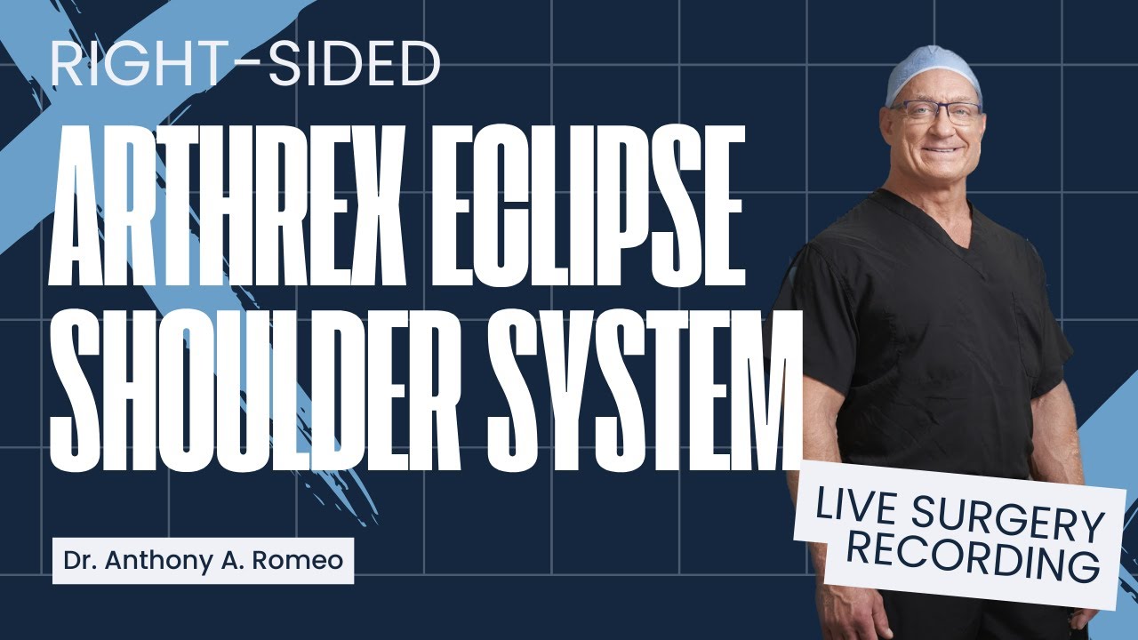 Right-Sided Arthrex Eclipse Shoulder System - Anthony A. Romeo, MD ...
