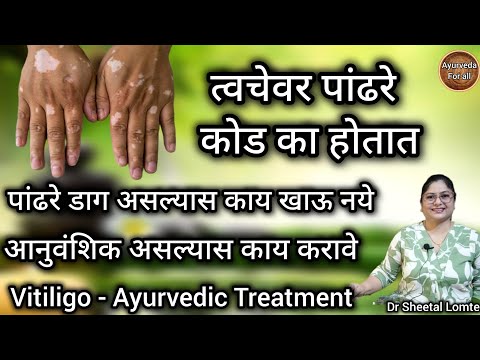 पांढरे कोड का होतात.त्वचेवर पांढरे डाग-काय खाऊ नये. Vitiligo Ayurvedic treatment. आनुवंशिक कोड