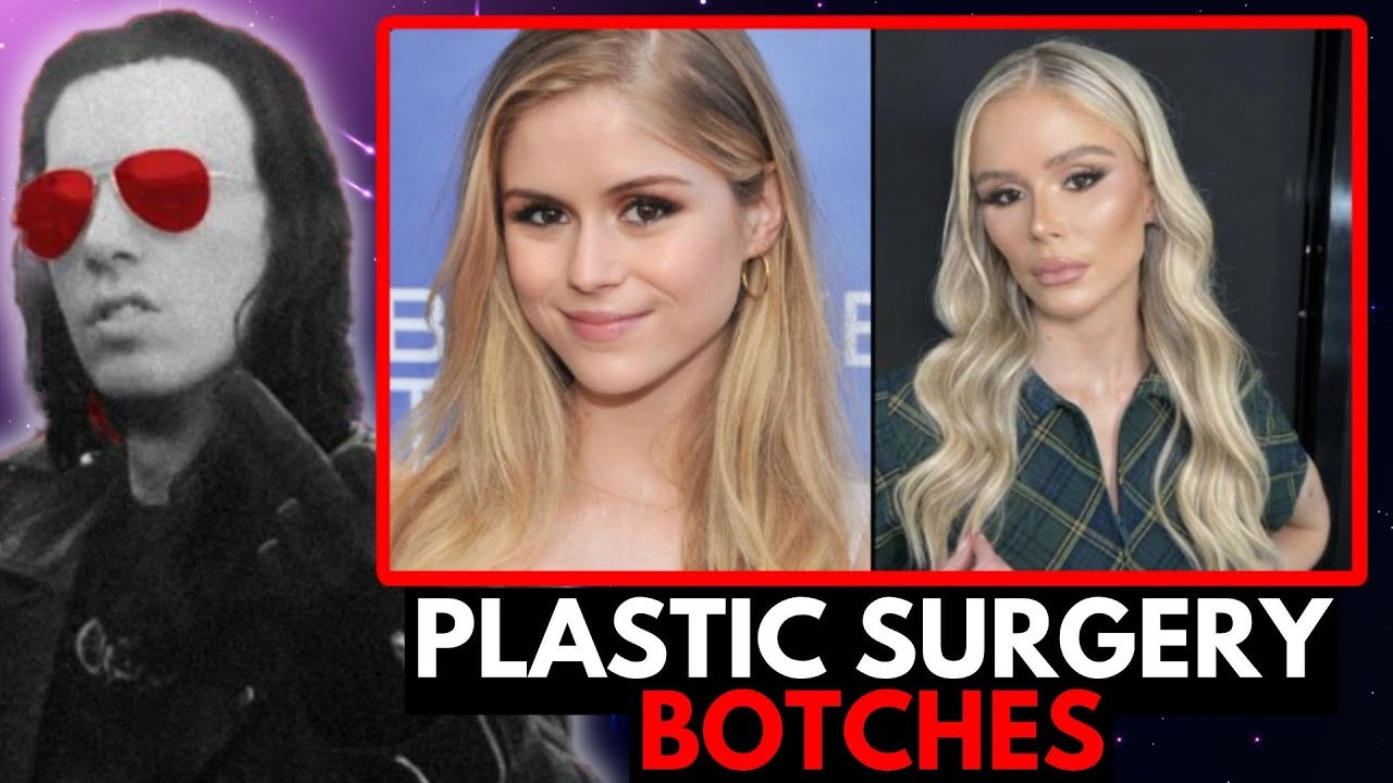 Razorfist on the Worst Plastic Surgery BOTCHES in Hollywood - YouTube