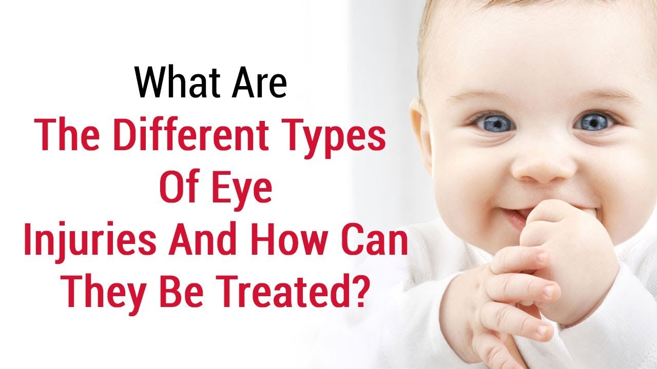 Types of eye injuries and necessary precautions | How to Treat An Eye ...