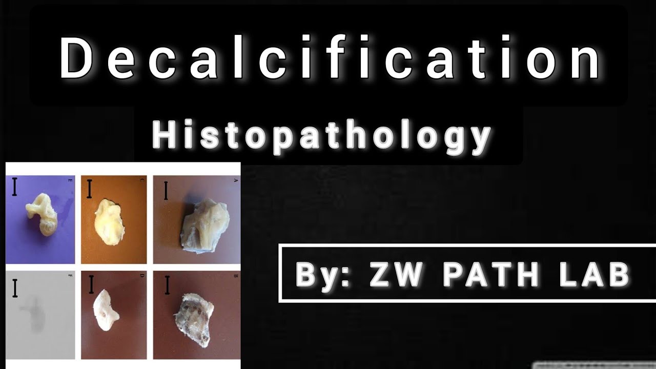 decalcification histopathology - YouTube