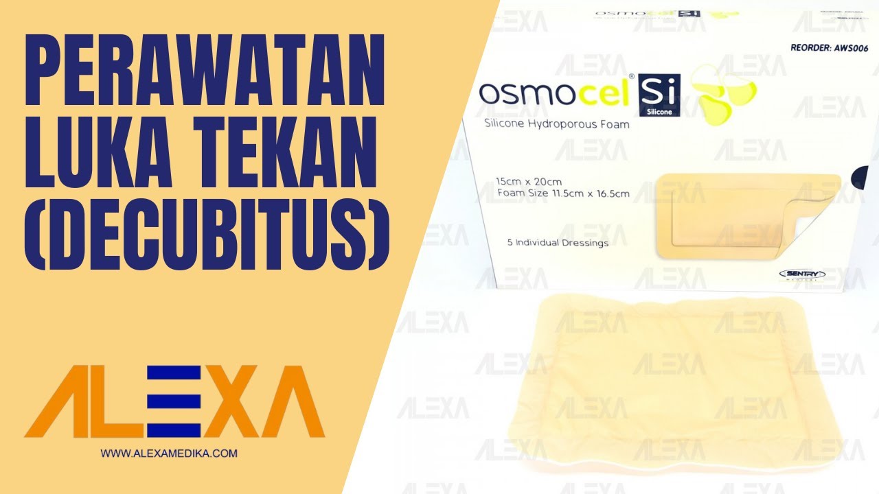 Perawatan Luka Tekan (Decubitus) dengan Osmocel Si - YouTube