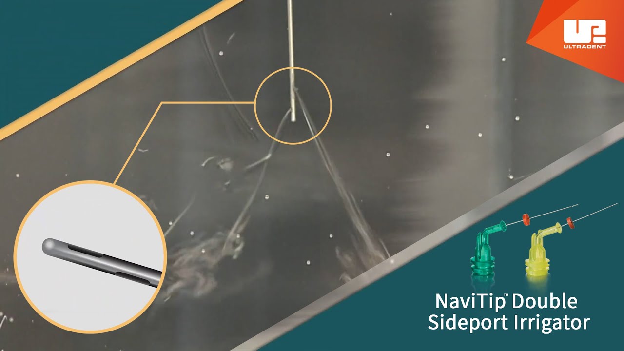 NaviTip Double Sideport Tip + Ultradent Irrigants—Made For Each Other ...