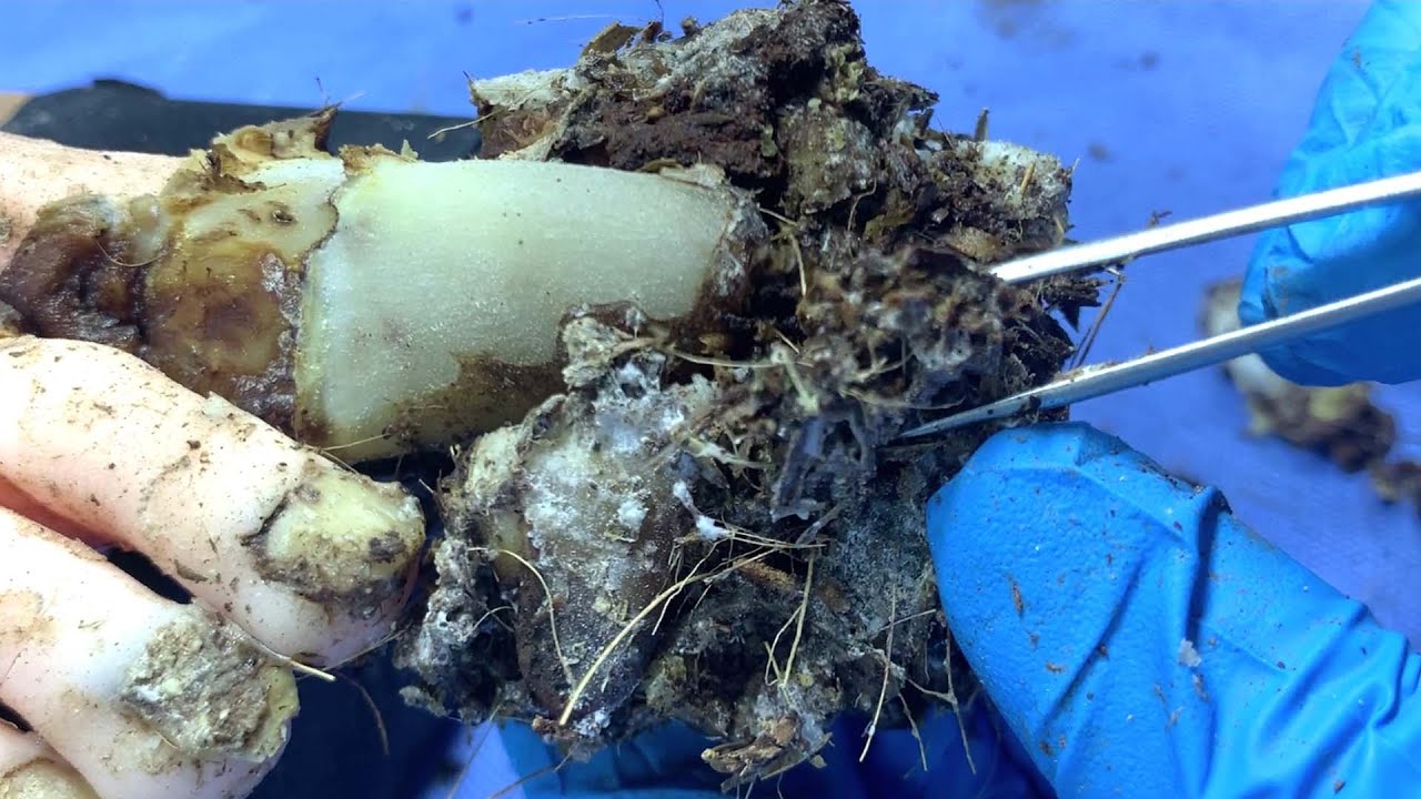 2916 Onychomycosis arches into a bridge, perfectly trimming the fungus ...