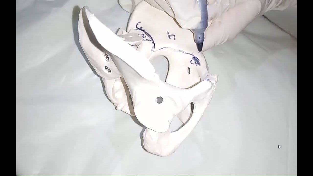Pelvis Anatomy | 8 landmarks of the pelvic brim - YouTube