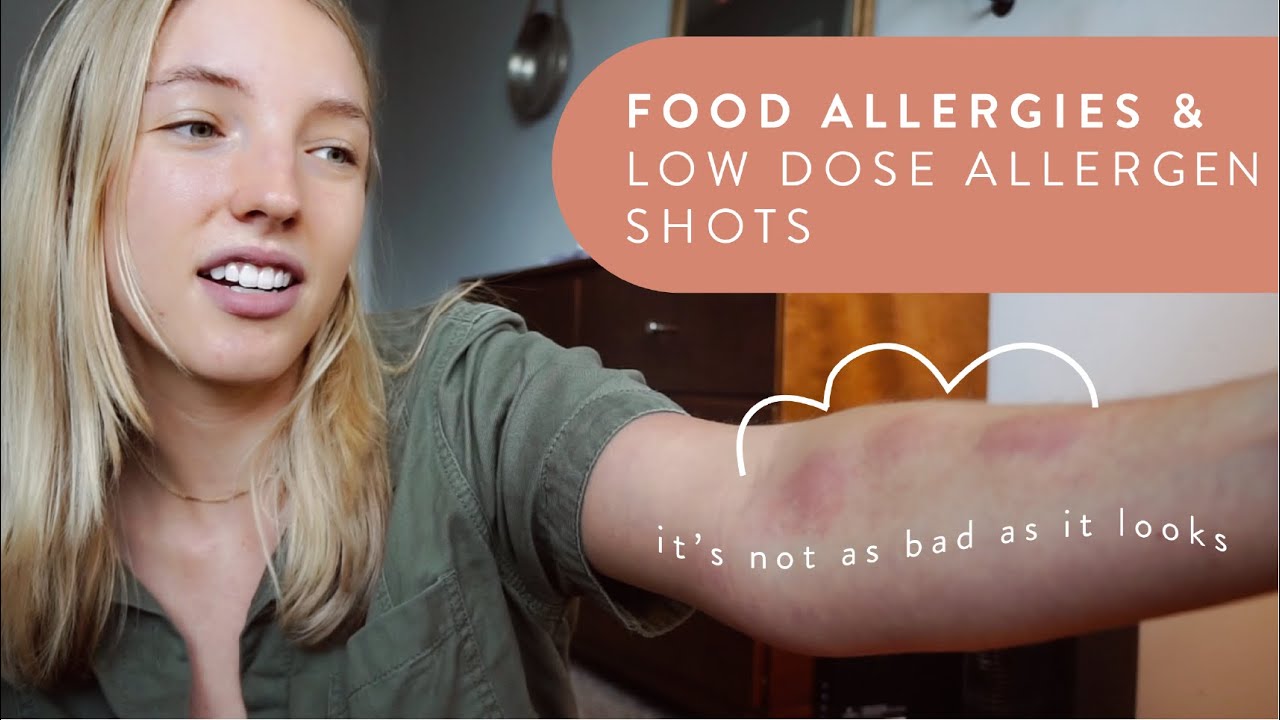 Food allergies and low dose allergen shots - YouTube