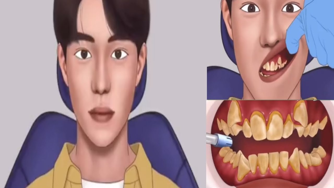 ASMR Treatment massive cheek hole piercing infection animation | Body ...