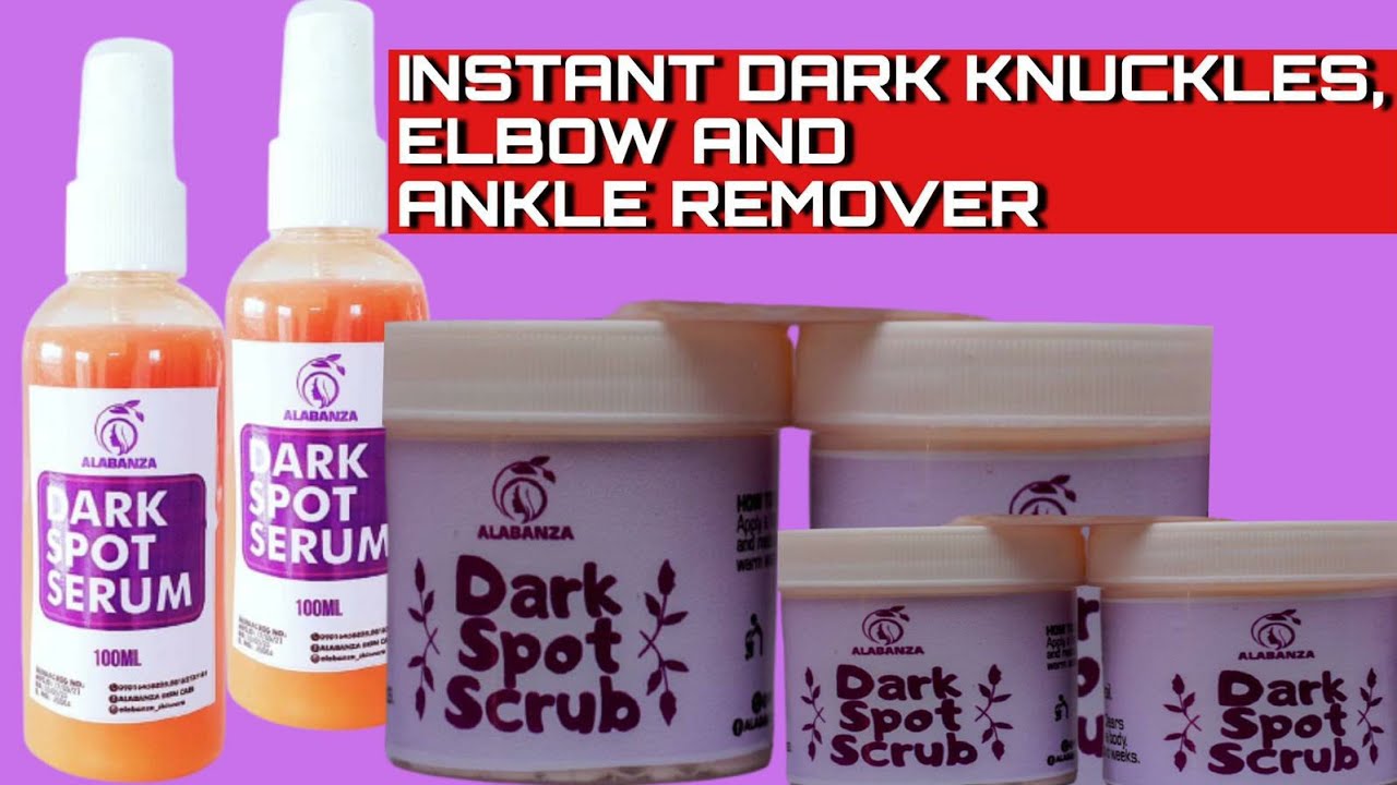 INSTANT DARK KNUCKLES + ANKLE REMOVER ( 100% EFFECTIVE ) - YouTube