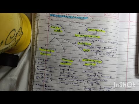 Posterior Teeth Selection Prosthodontics - YouTube