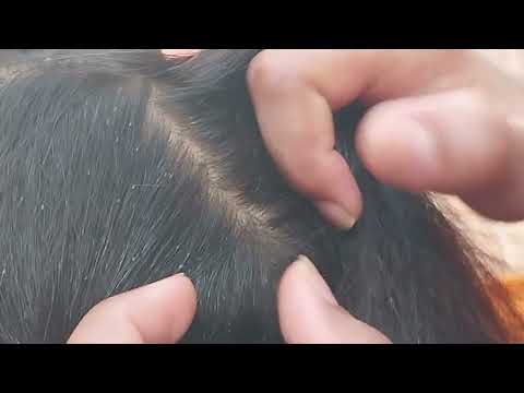 Nitpicking ASMR video 358 , Deep Hair Cleansing, Kuto, Piolhos, Petantumo, Catarpiolhos, Lice Care