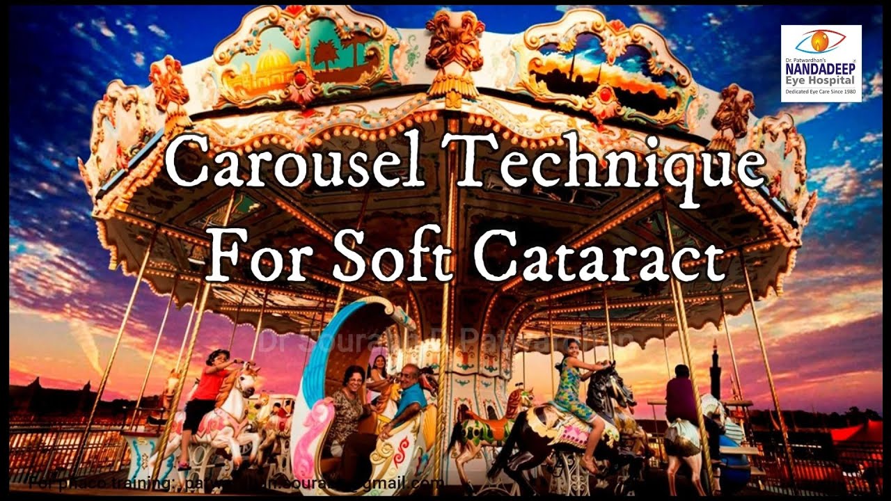 Carousel technique for soft cataract with animation Dr Sourabh ...