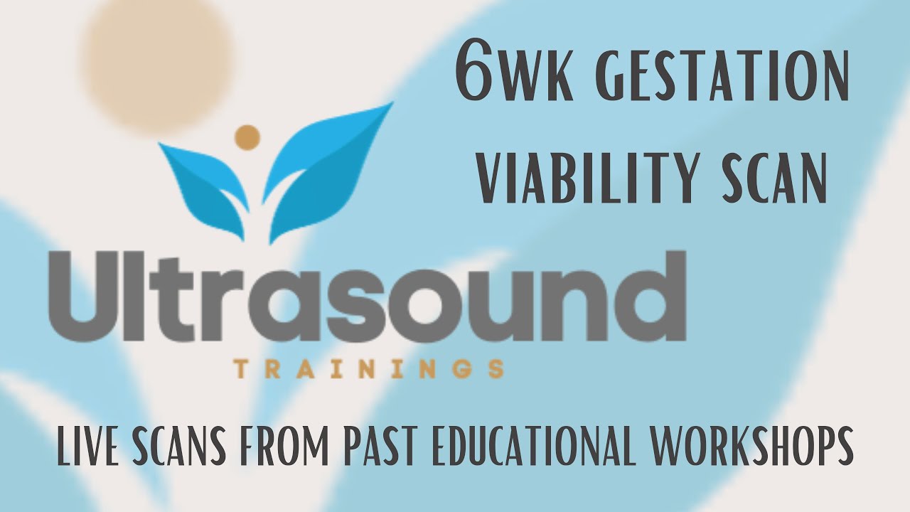 6 Week Gestational Age Viability Scan - Ultrasound Trainings - YouTube