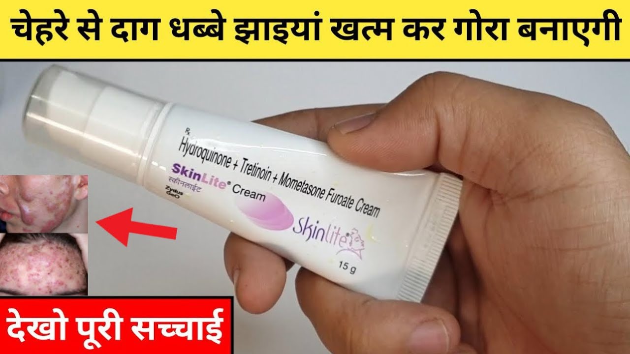 SkinLite Cream Review in Hindi | r 1 fairness cream | Skin lite Cream ...