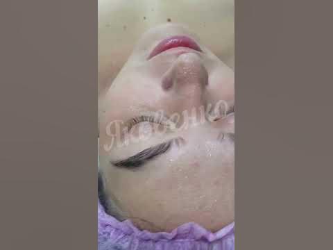 Карамельная липосакция лица - YouTube