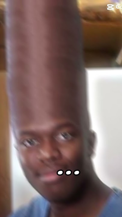 The real biggest forehead💀 - YouTube