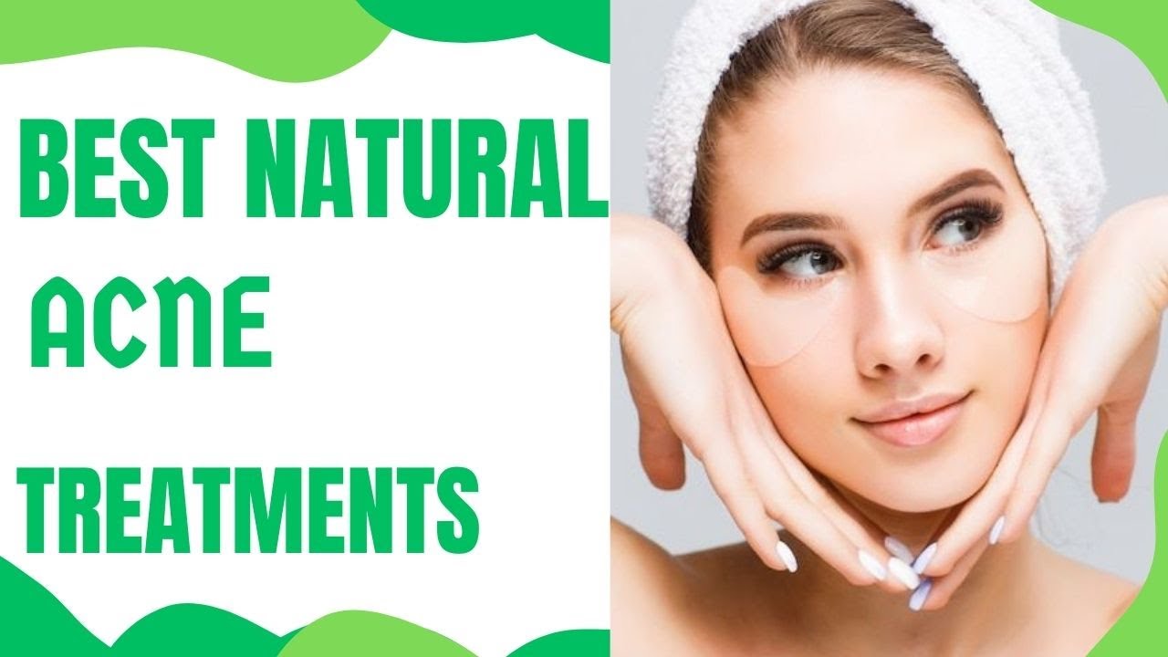 Best Natural Acne Treatments You Need to Try at Home Today! - YouTube