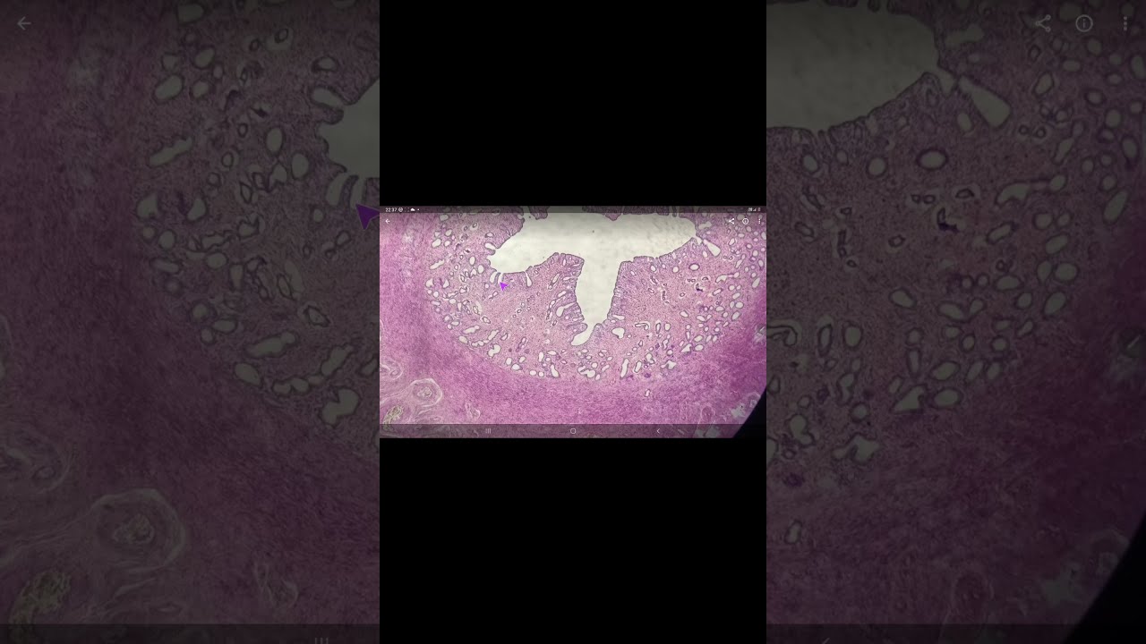 Histology of Uterus slide identification and explanation - YouTube