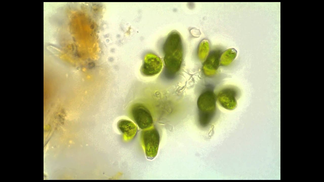 Dimorphococcus, a green alga - YouTube