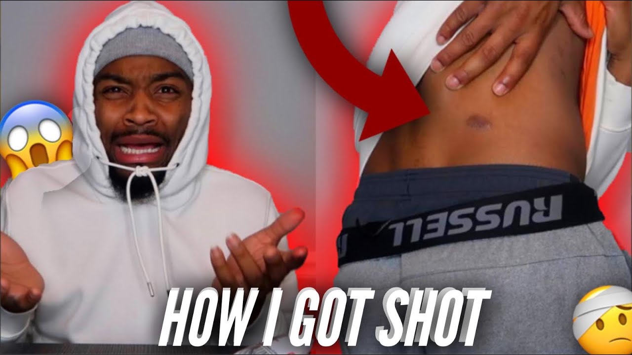 STORY TIME: How I Got Shot!!!😰😱💥 - YouTube