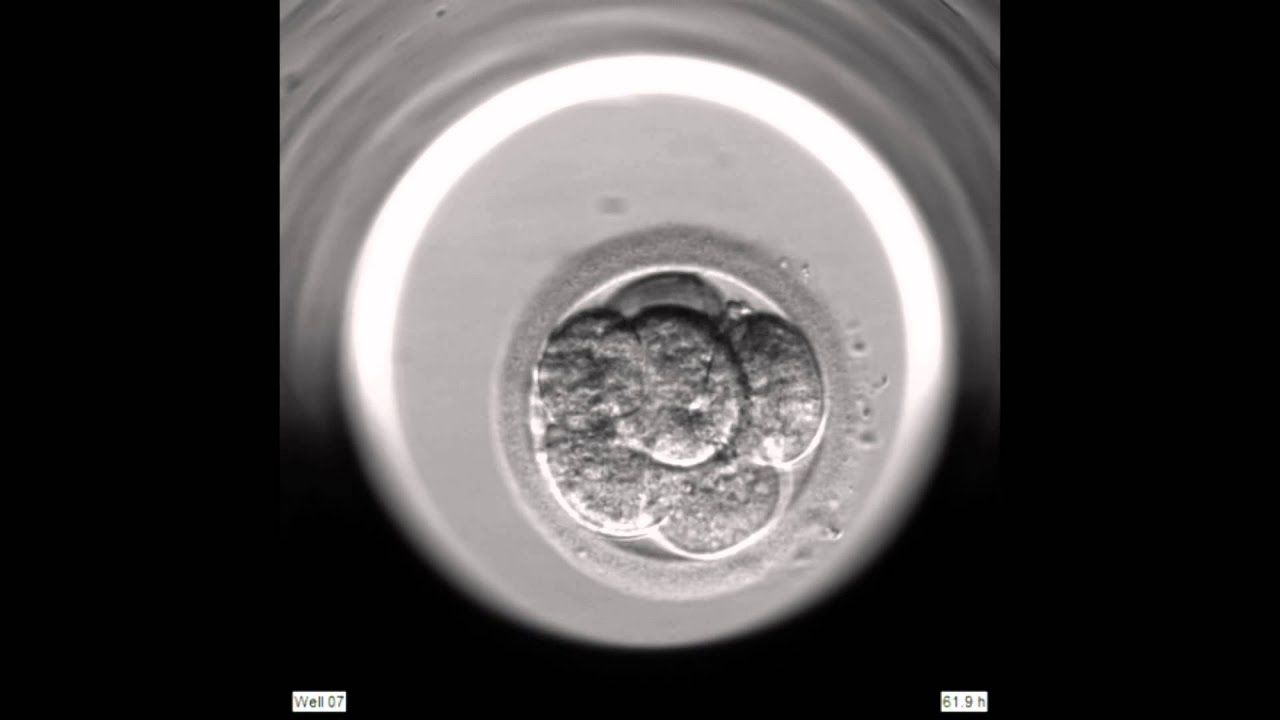 EmbryoScope Embryo Development - Blastocyst - YouTube