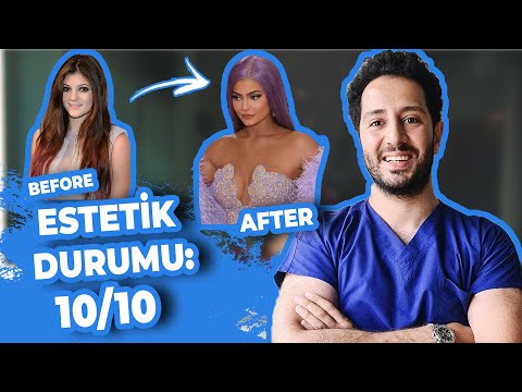 Cem Hamidi ile Estetik Durumu! #1 | Kim Kardashian, Kylie Jenner