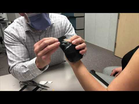 Video 5 - Fabrication of Dorsal Hand Based Intrinsic Plus Orthosis ...