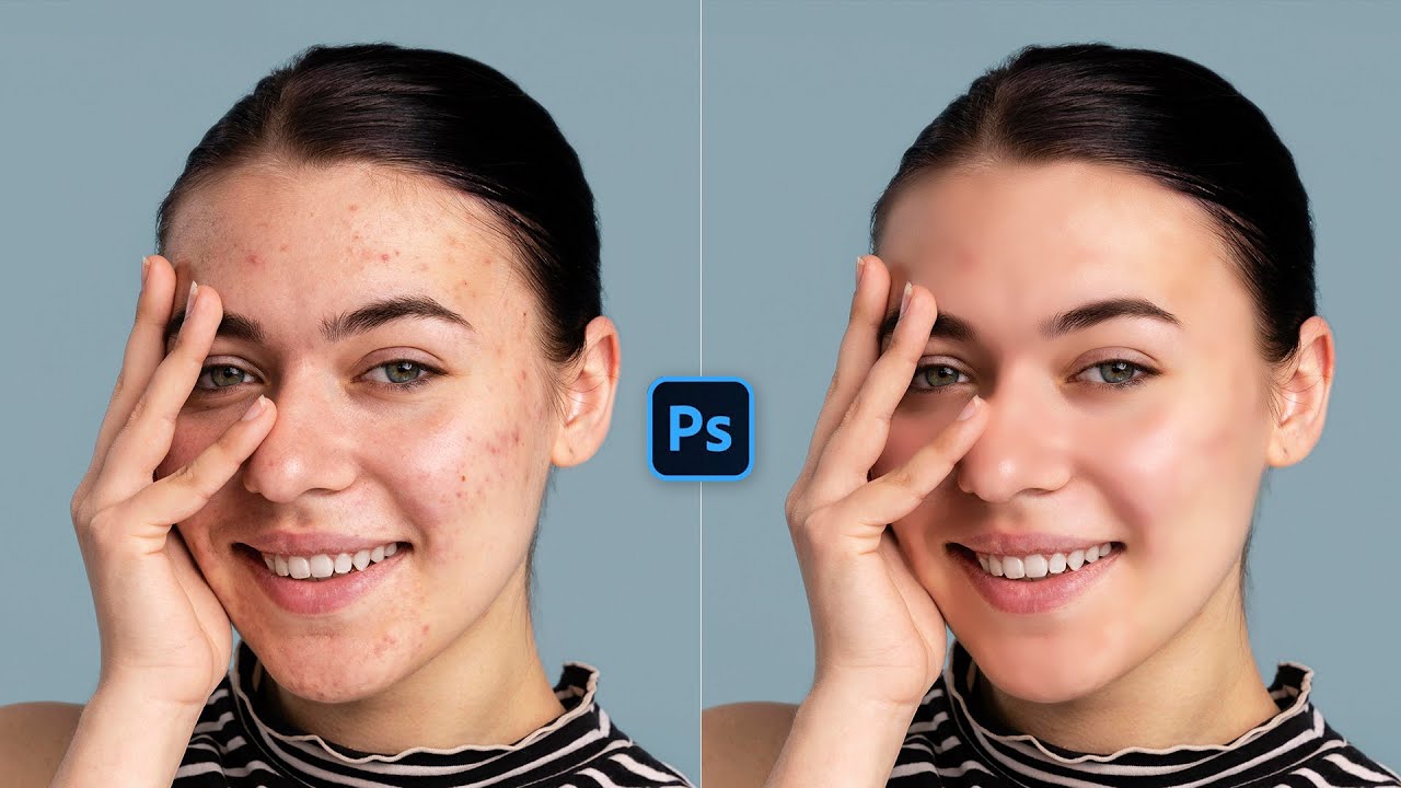 Photoshop Most Used Skin Retouching Technique Tutorial | Photoshop ...