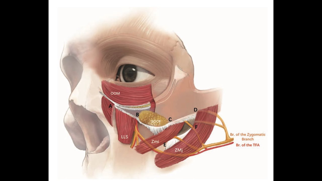 Anatomy Review--The SMAS (and its importance in facelifts) by Dr. Parsa ...