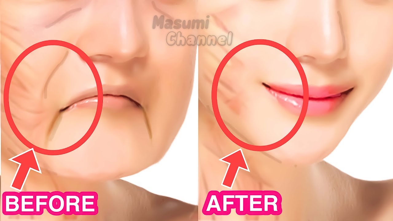 Anti Aging Face Lifting Massage With Oil For Jowls Laugh Lines Droopy