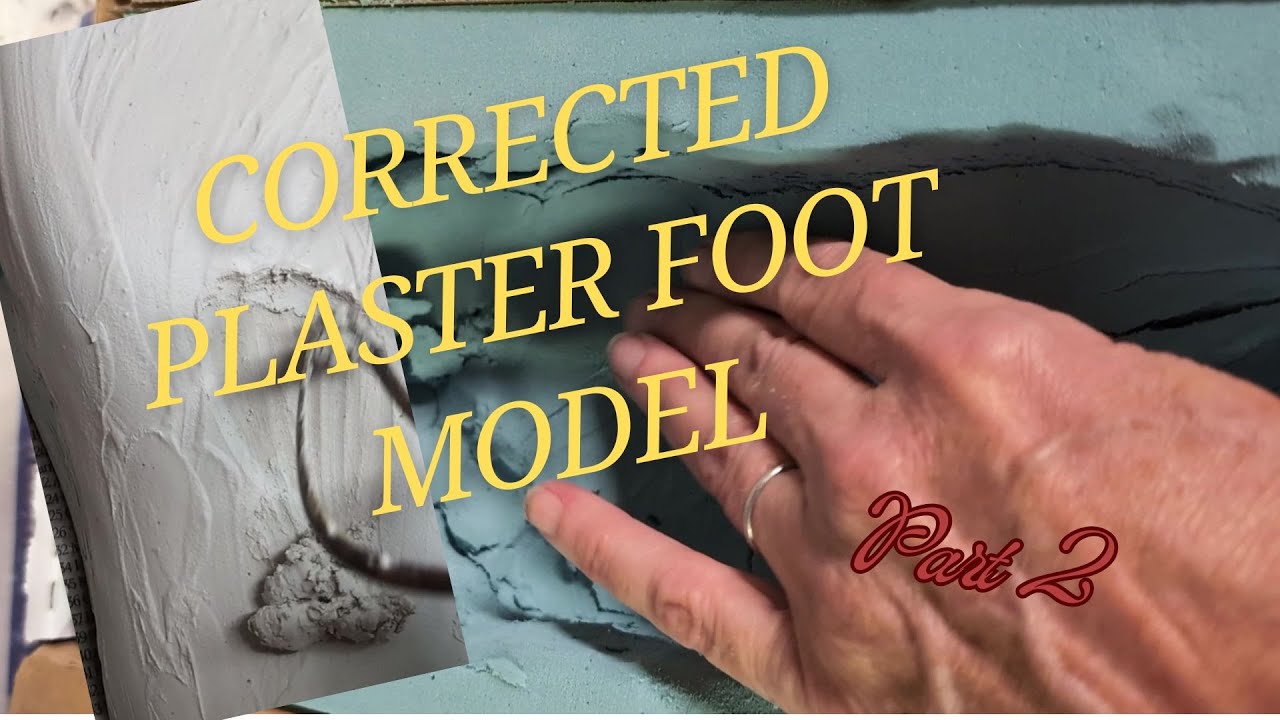 Corrected Plaster foot Model, Part 2 - YouTube