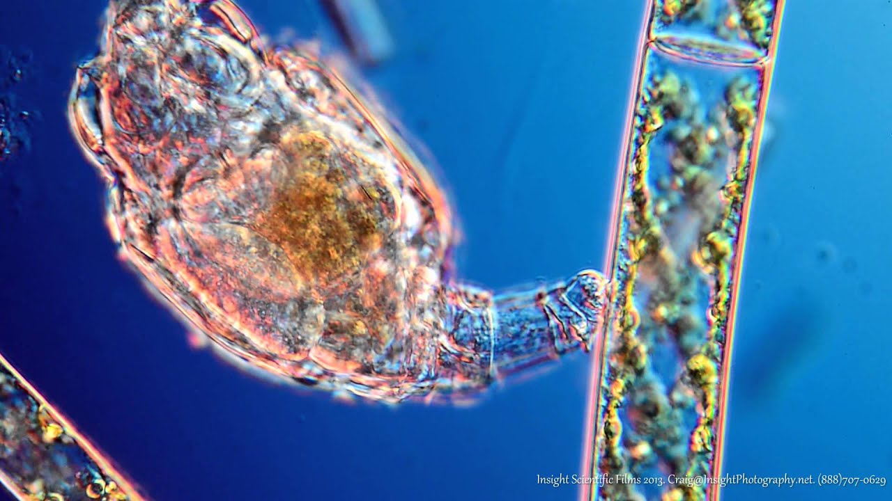 Rotifera. 325x. DIC. - YouTube