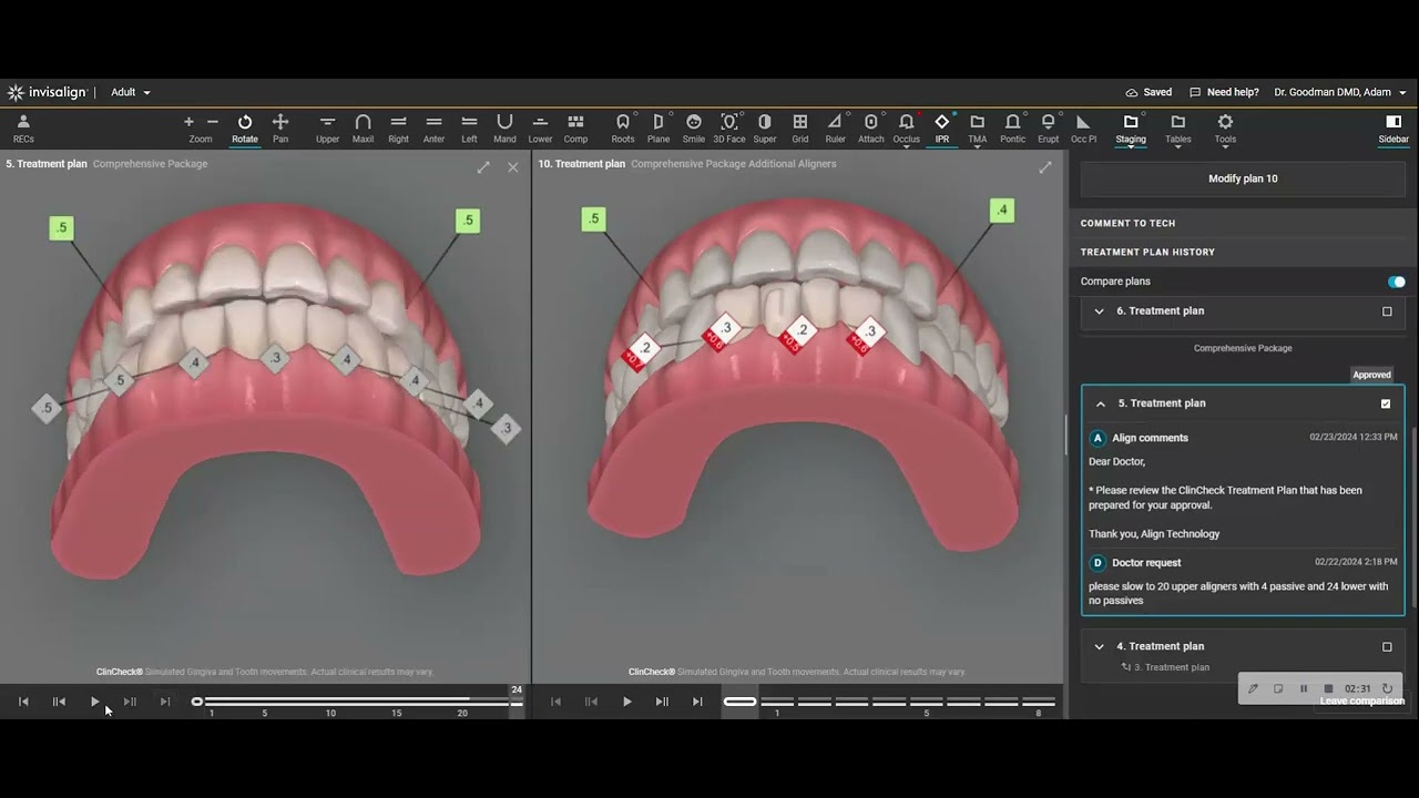 A trick to correct anterior crossbites with orthodontics and Invisalign ...