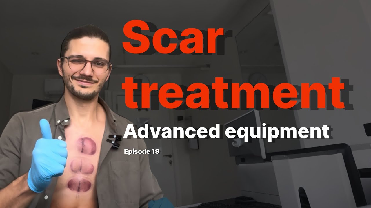 Scar Mobilization After Open Heart Surgery | Advanced Equipment for ...