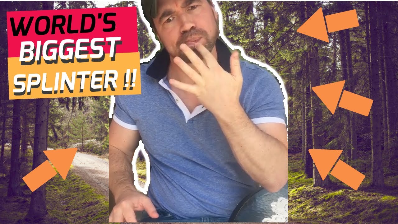 World's biggest splinter !! - YouTube