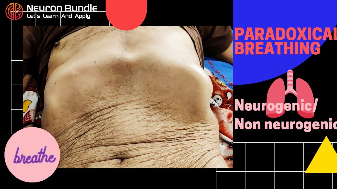 Paradoxical Breathing Pattern Diaphragmatic Paradox 
