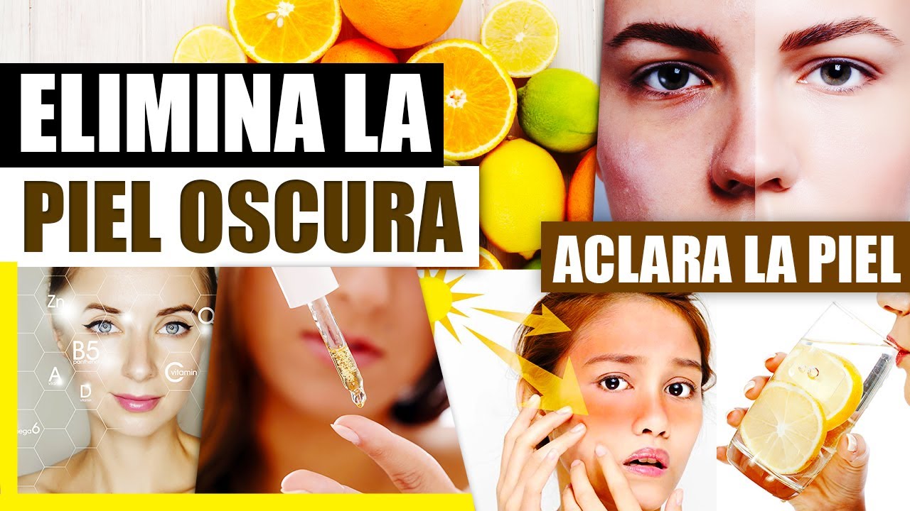 5 Maneras De Eliminar La Piel Opaca - Aclara Tu Piel NATURALMENTE ...