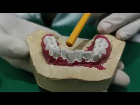 Dental anatomy spotters - First BDS - YouTube