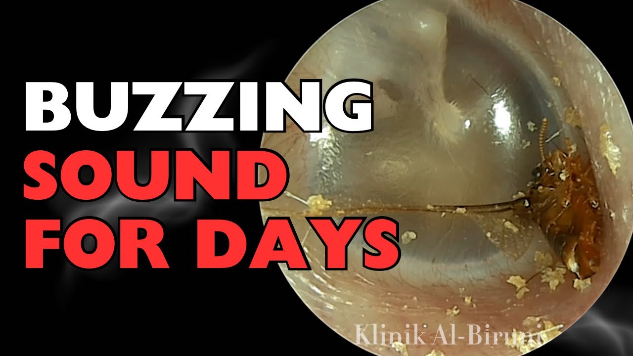 Buzzing Sound For Days Finally Explained - YouTube