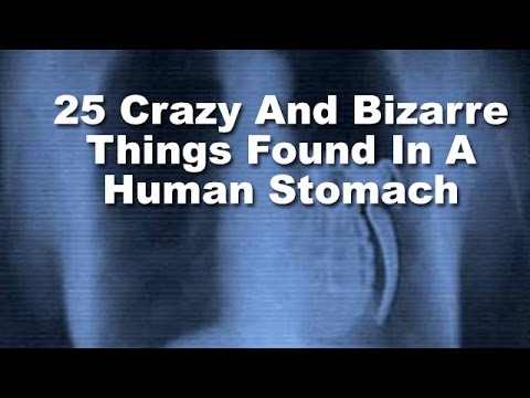 25 Crazy And Bizarre Things Found In A Human Stomach - YouTube