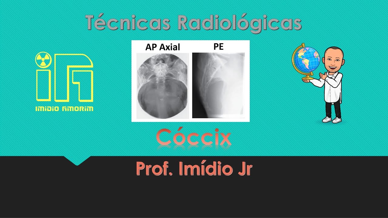 Raio X Coccix Normal - RETOEDU