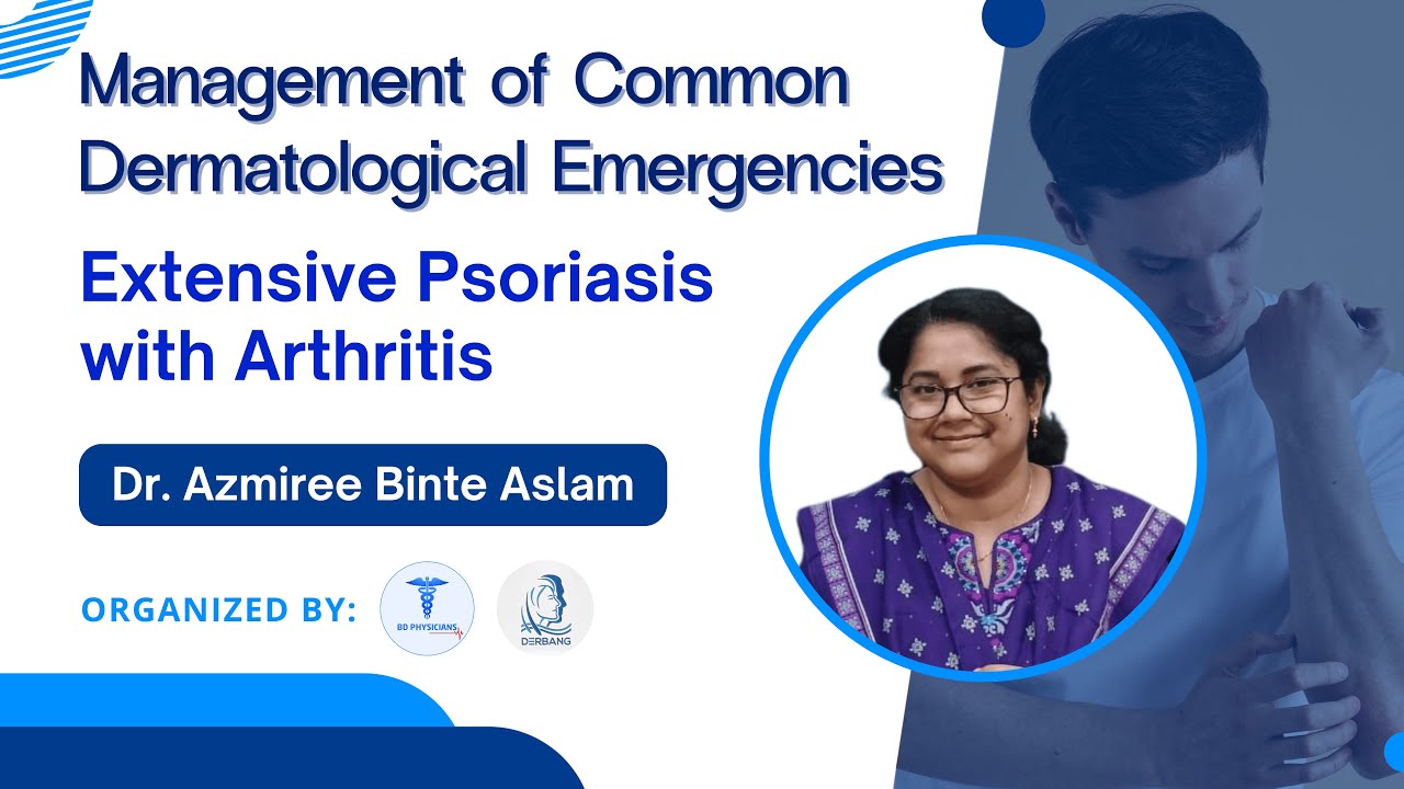 Extensive Psoriasis with Arthritis. | BD Physicians - YouTube