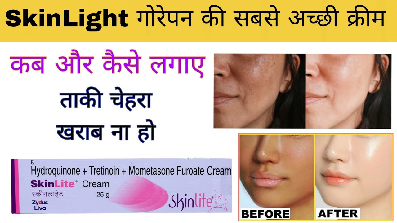 Honest Review of skinlite cream in हिंदी | गोरेपन की क्रीम | uses and ...