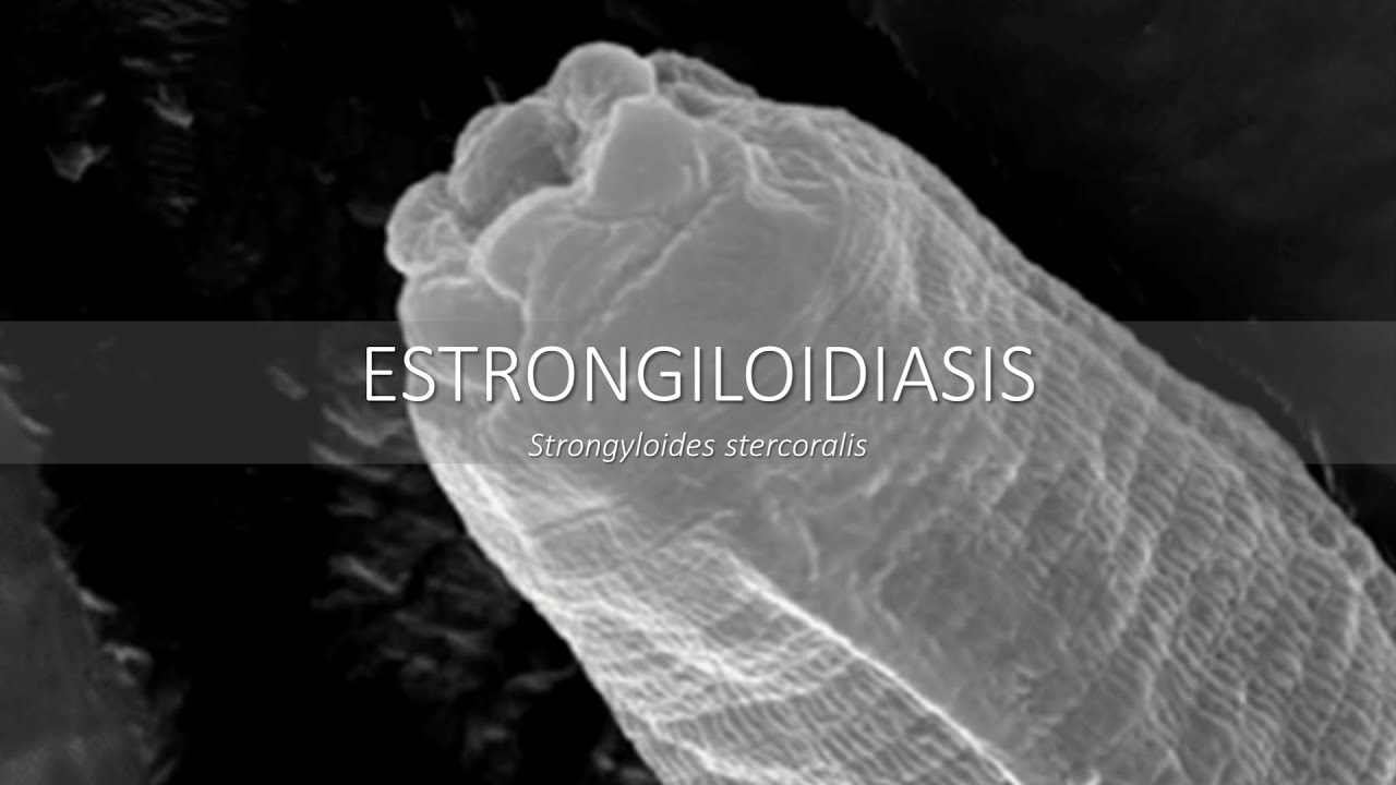 Estrongiloidiasis, PRESENTACIÓN (resumen + memorización) - YouTube