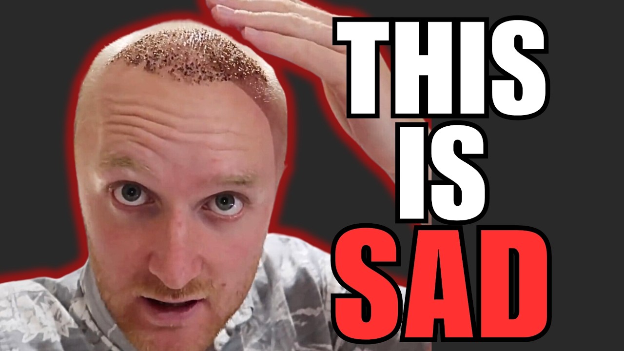 YouTuber Gets BRUTALLY TROLLED For His BALDING - YouTube