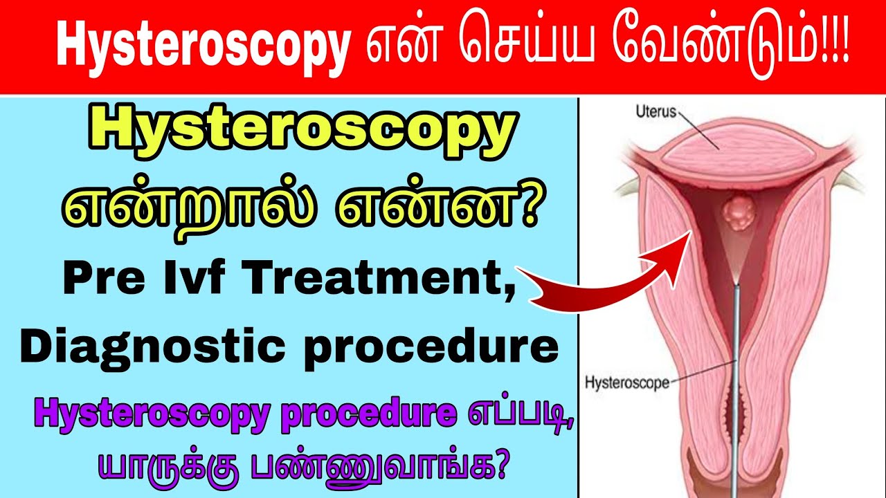 Hysteroscopy || Pre IVF treatment ||Hysteroscopy ivf முன்னாடி எதுக்காக ...