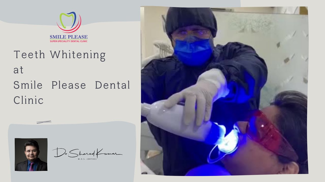 Teeth Whitening in One Hour... In Office bleaching of Teeth - YouTube