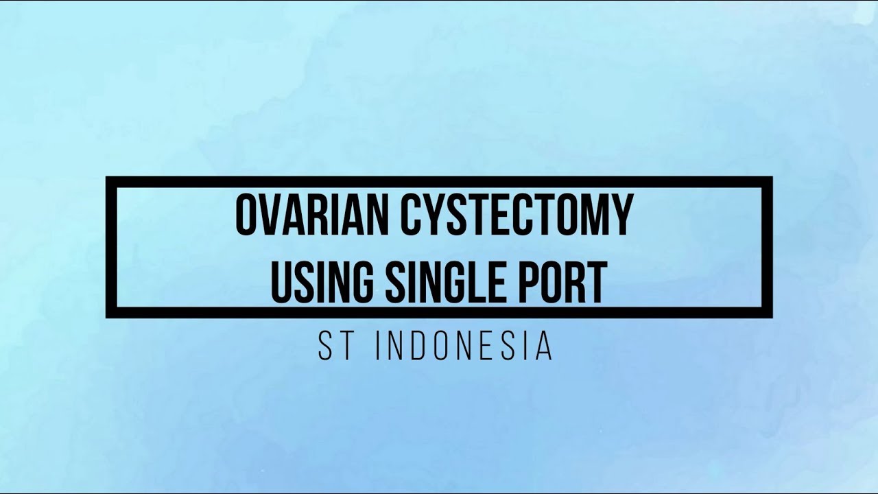 OVARIAN CYSTECTOMY USING SINGLE PORT - YouTube